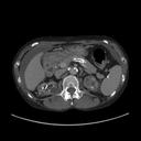 SOMATOM Definition Flash - CT Scanner