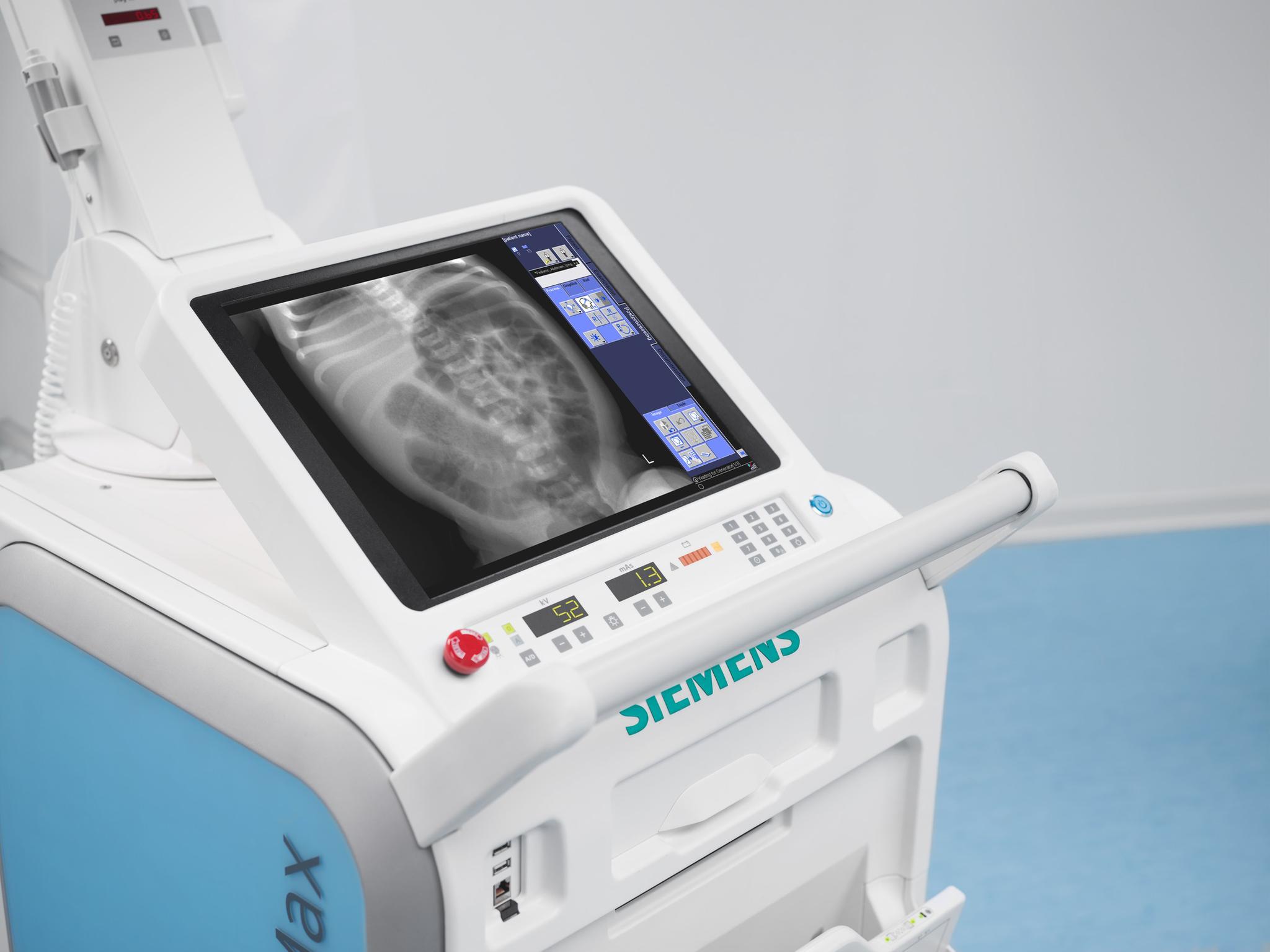 Mobilett Mira Max - Mobile X-ray Machine