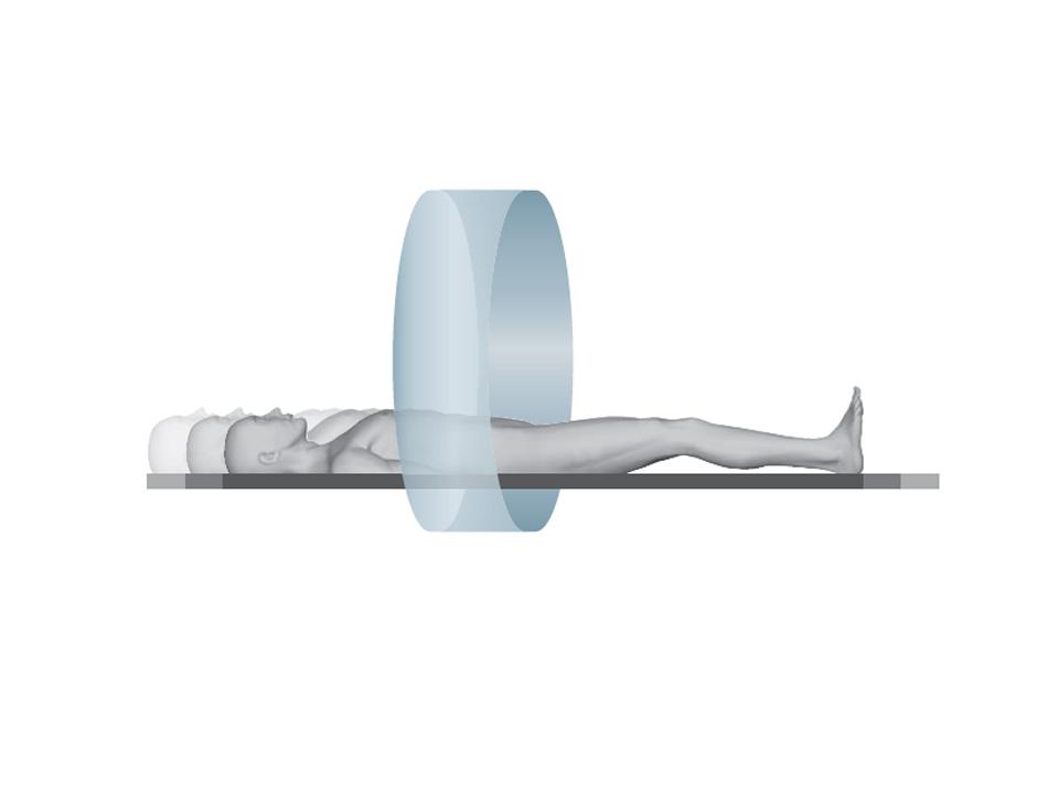 SOMATOM Definition Edge