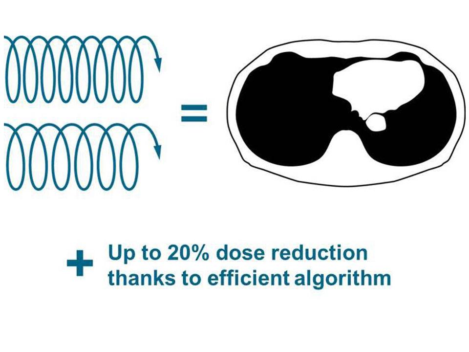 CT Scanner SOMATOM Scope