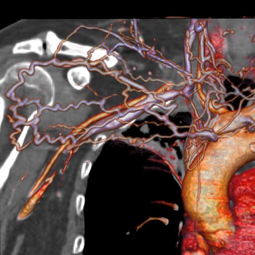 CT Scanner SOMATOM Scope