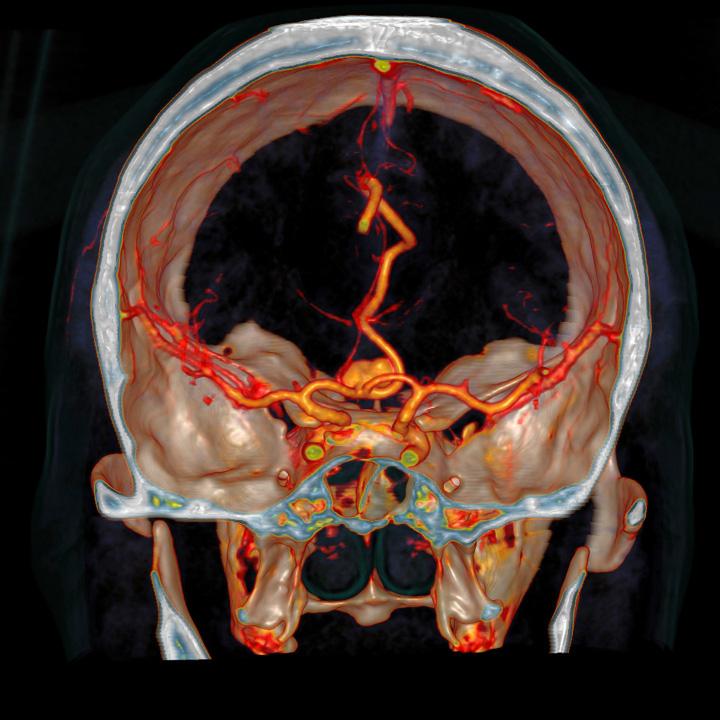CT Scanner SOMATOM Scope