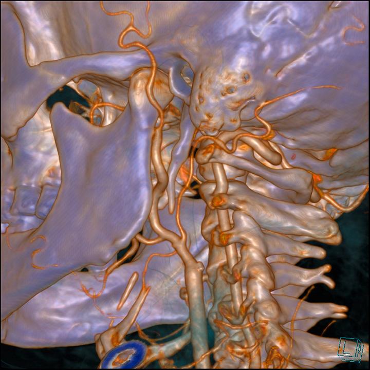 CT Scanner SOMATOM Scope