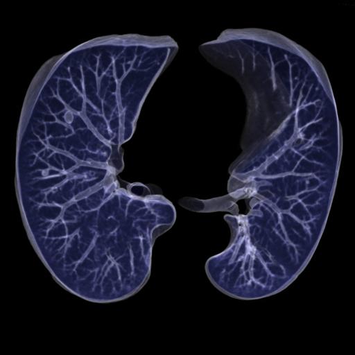 CT Scanner SOMATOM Scope