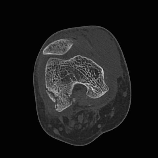 CT Scanner SOMATOM Scope