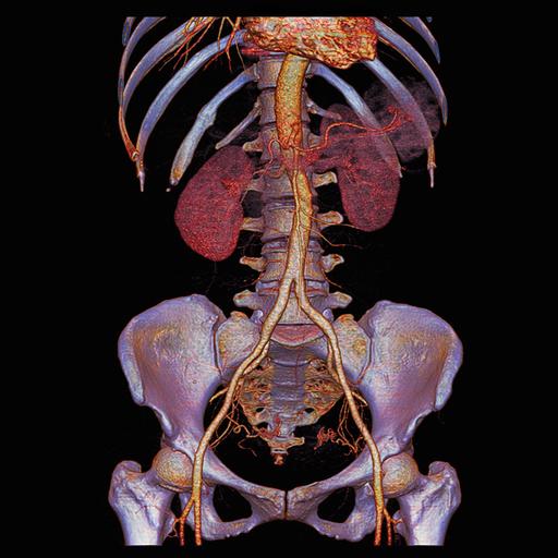 CT Scanner SOMATOM Scope
