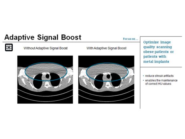 CT Scanner SOMATOM Scope