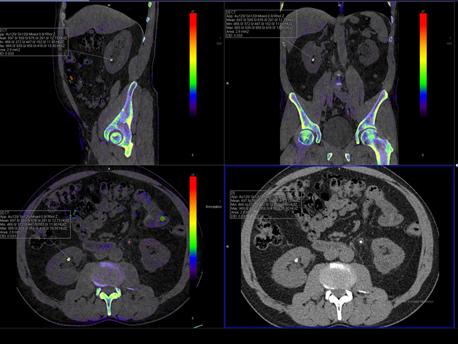 Get further. With True Dual Energy.