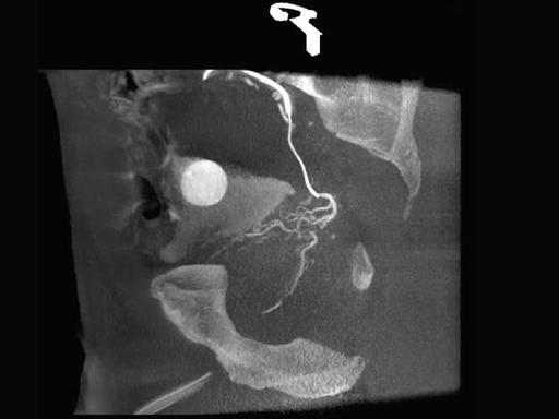 Peripheral and Vascular Interventions