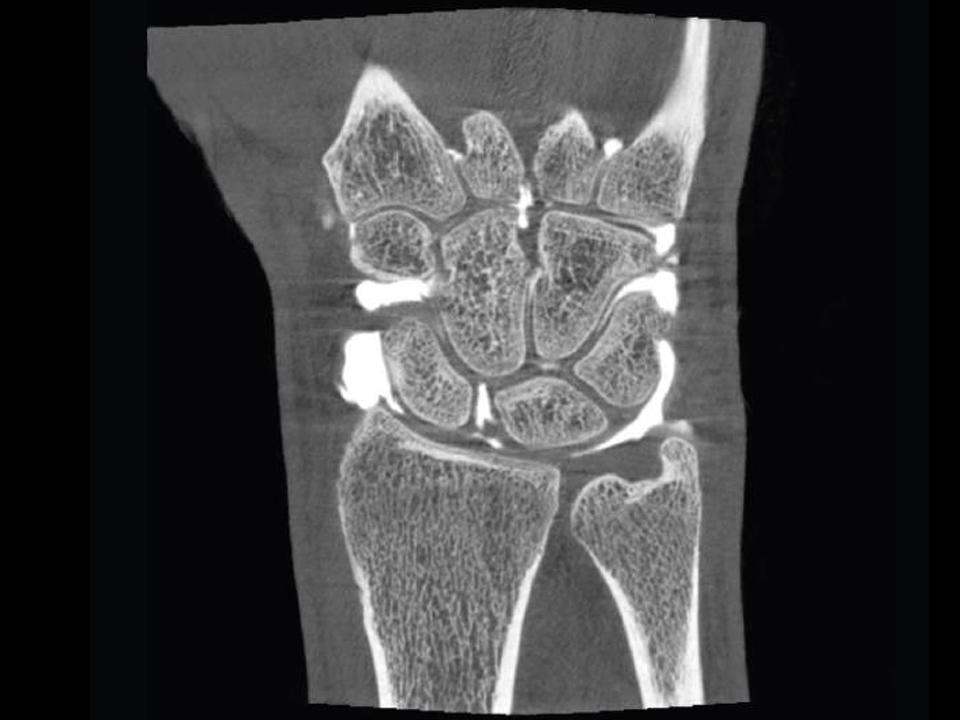Peripheral and Vascular Interventions