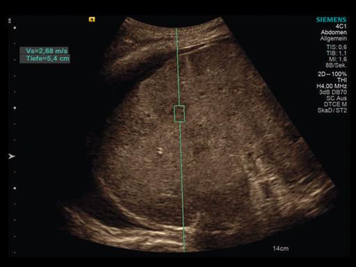 ACUSON S2000 Ultrasound System, HELX Evolution with Touch Control