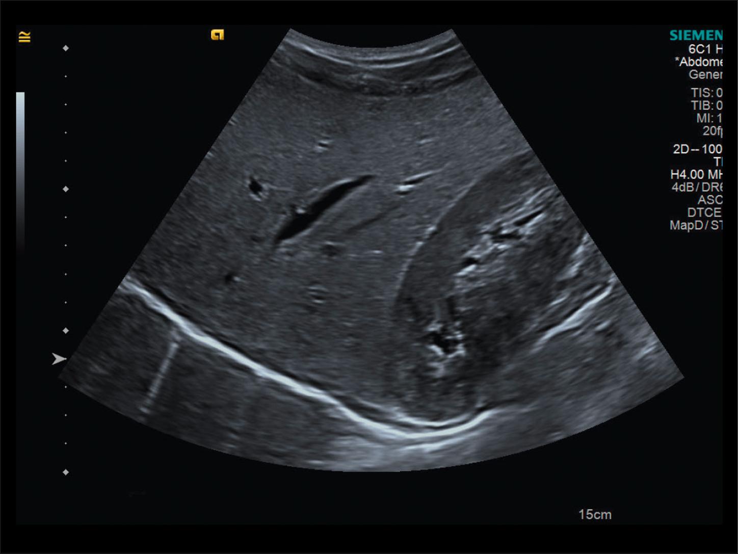 ACUSON S2000 Ultrasound System, HELX Evolution with Touch Control