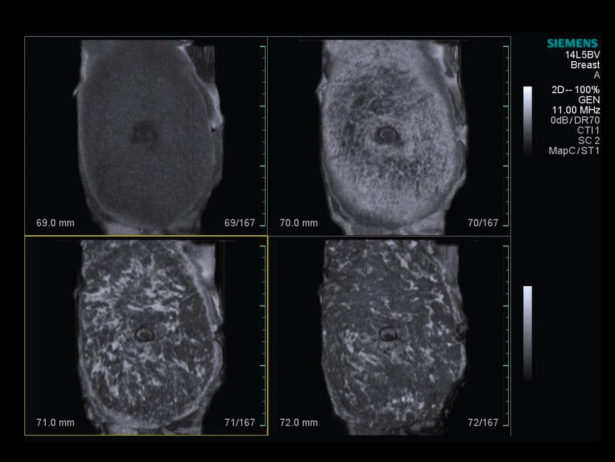 ACUSON S2000 HELX Evolution