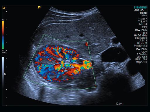 ACUSON S Family of Ultrasound Systems, HELX Evolution with Touch Control