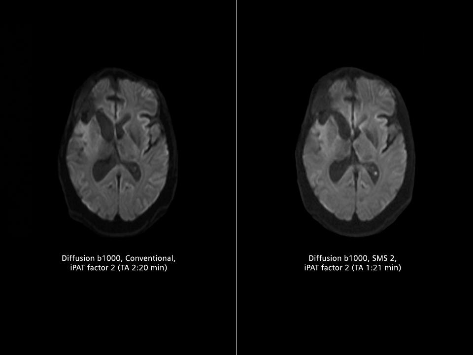 Magnetic Resonance Imaging - Clinical Software Applications