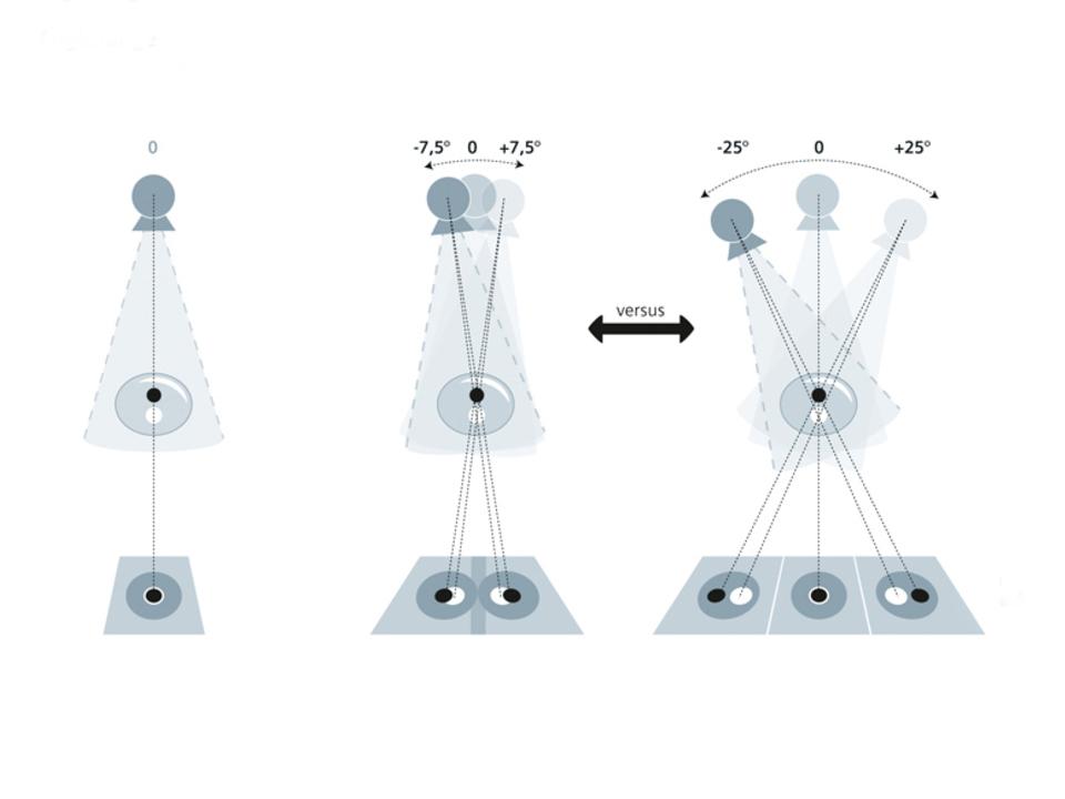 High Definition Breast Tomosynthesis