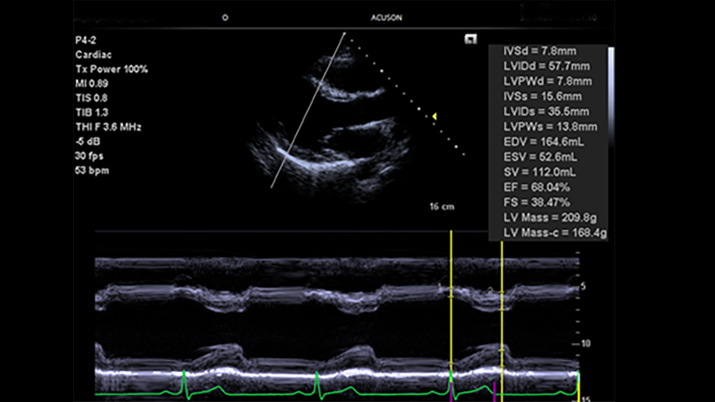 ACUSON P500 Ultrasound System