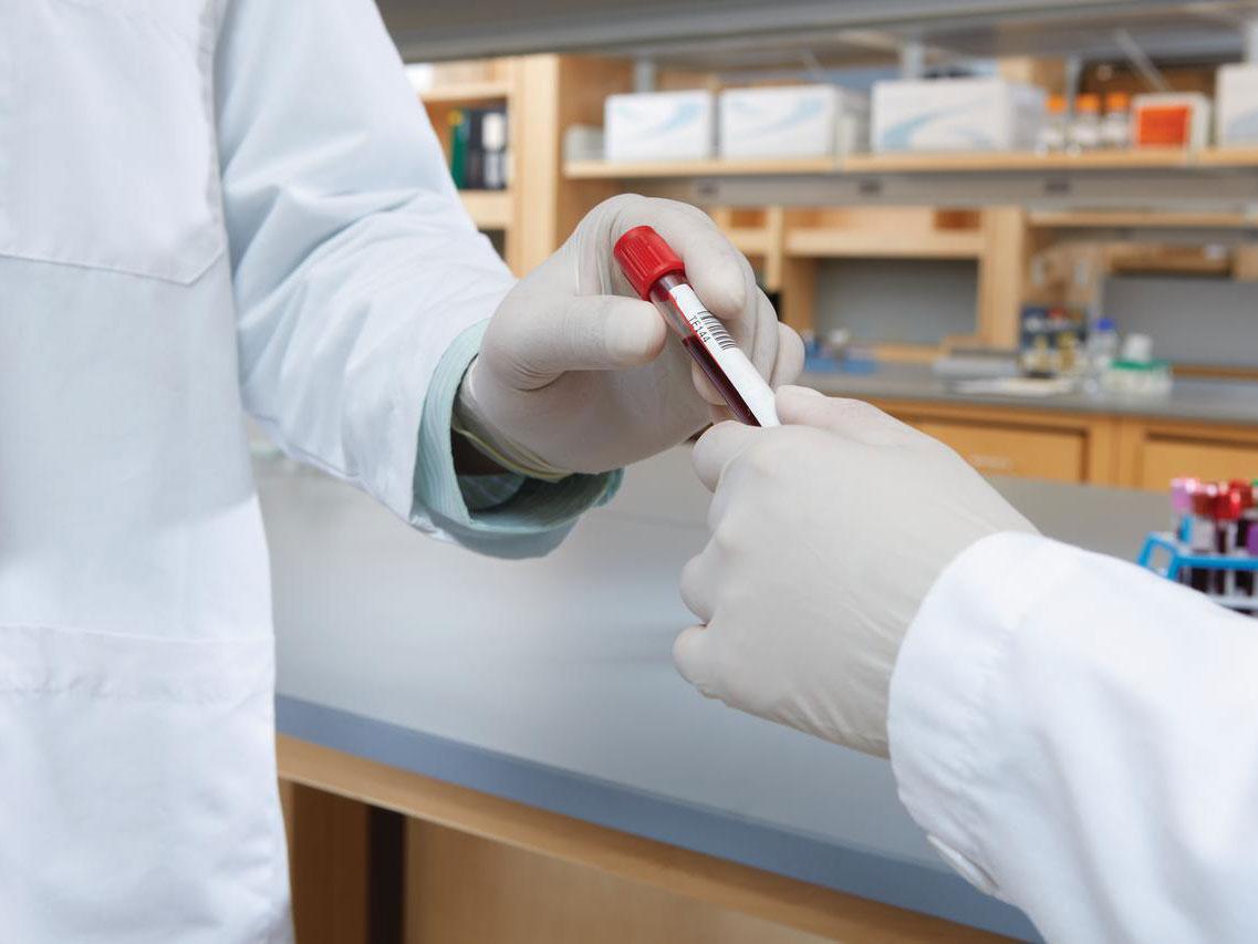 Torch Disease Testing at Jasper Saranealis blog