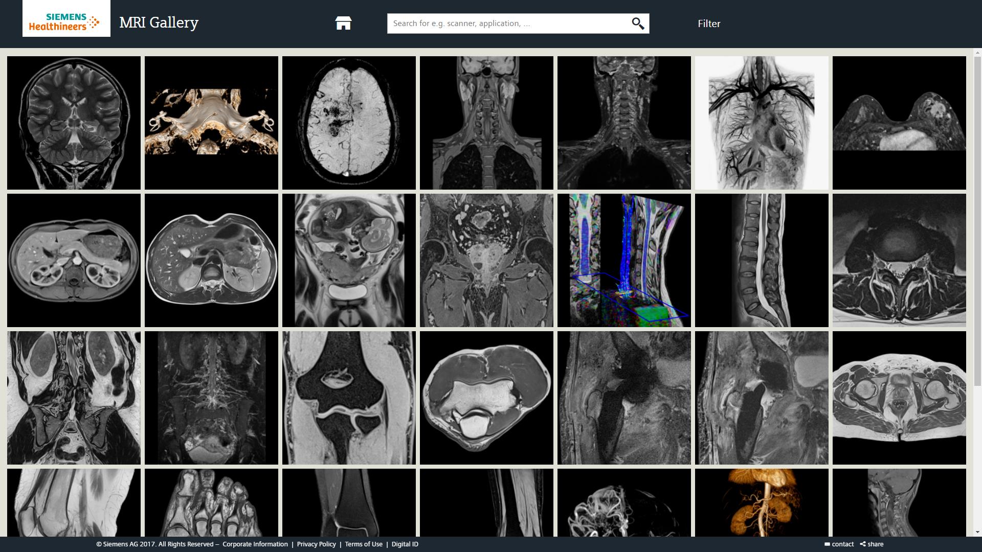 MAGNETOM Prisma - MRI Scanner