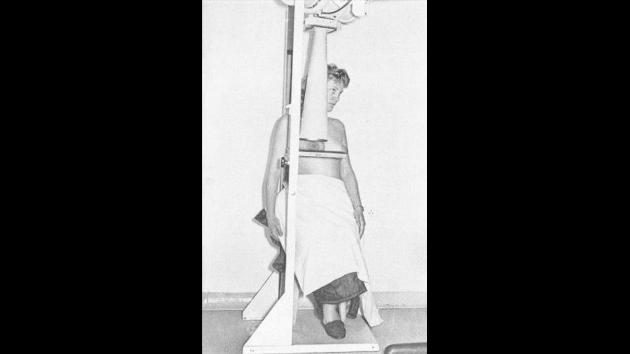 Siemens Healthineers history in mammography