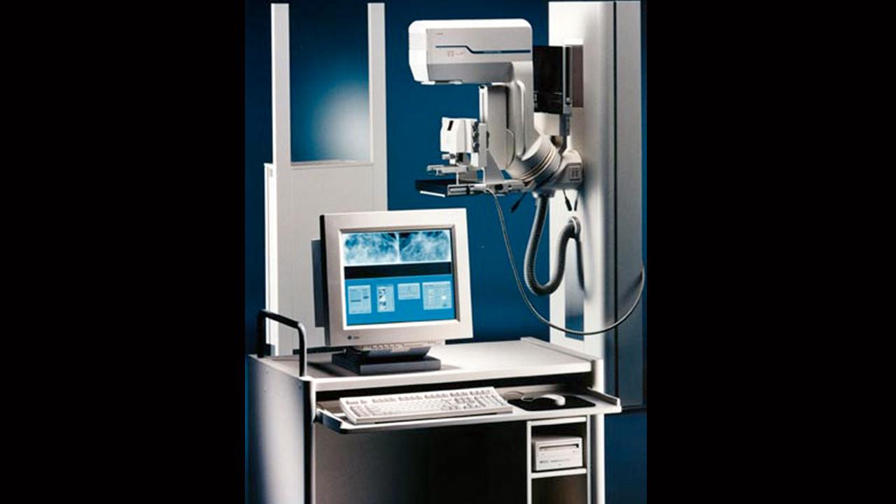 History of mammography: 1991 – 1994