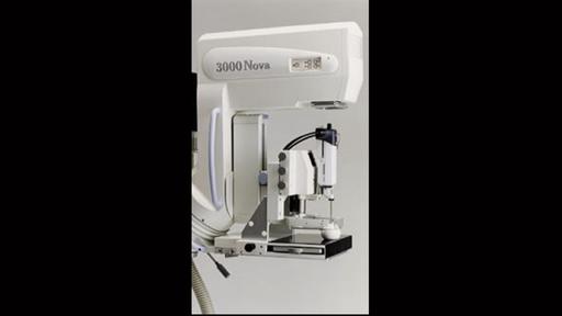 History of mammography: 1991 – 1994