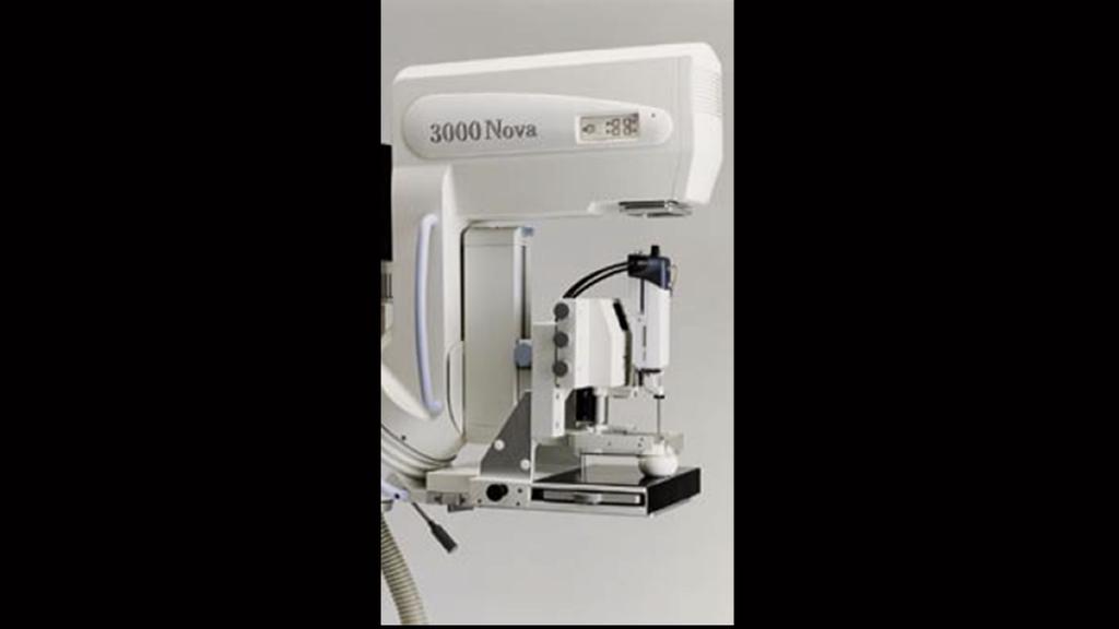 History of mammography: 1991 – 1994