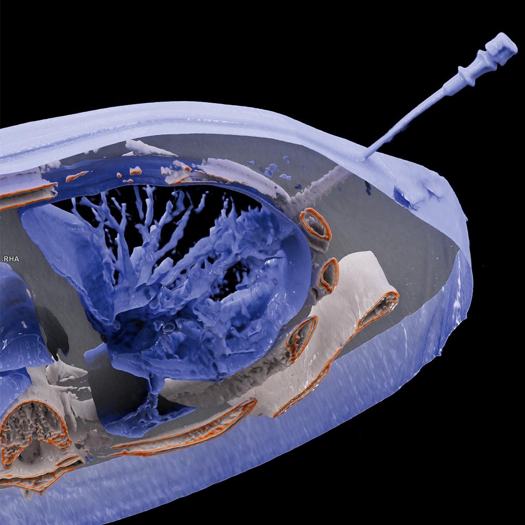 Somatom Go.Top – Hoàng Hà JSC