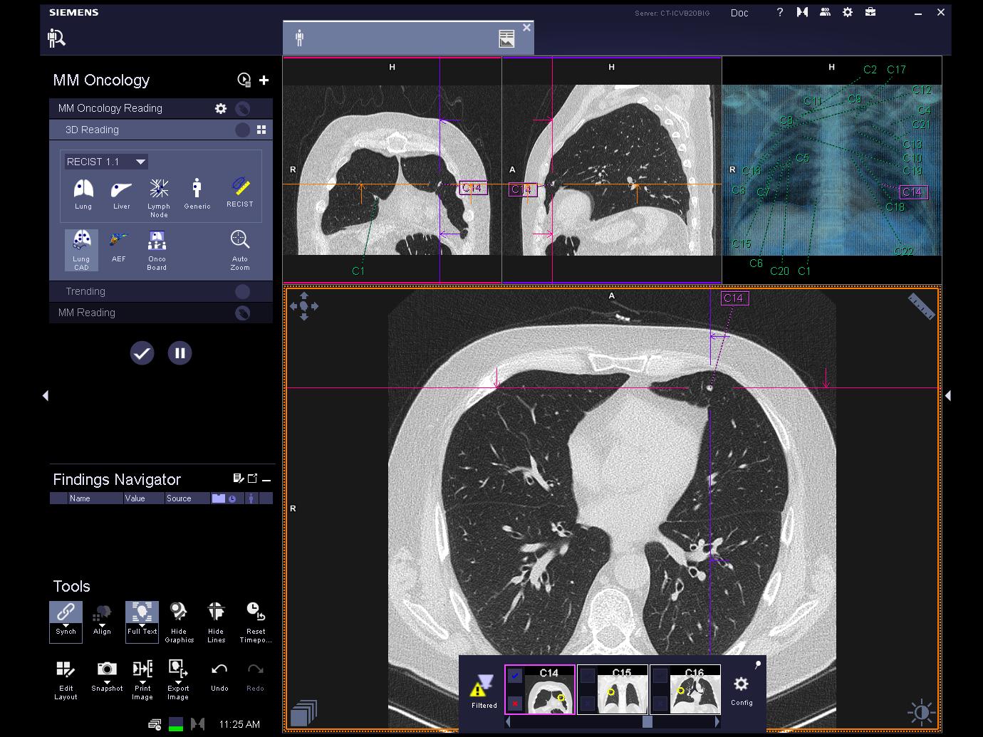 Options & Upgrades - Get the most from your investment