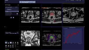 syngo.via for MRI