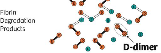 D-dimer