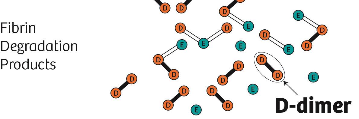 D-dimer