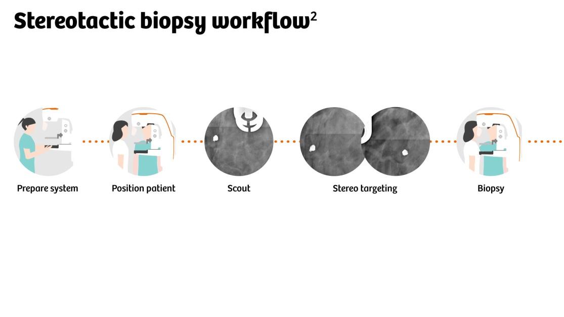 Tomo biopsy: What it's all about