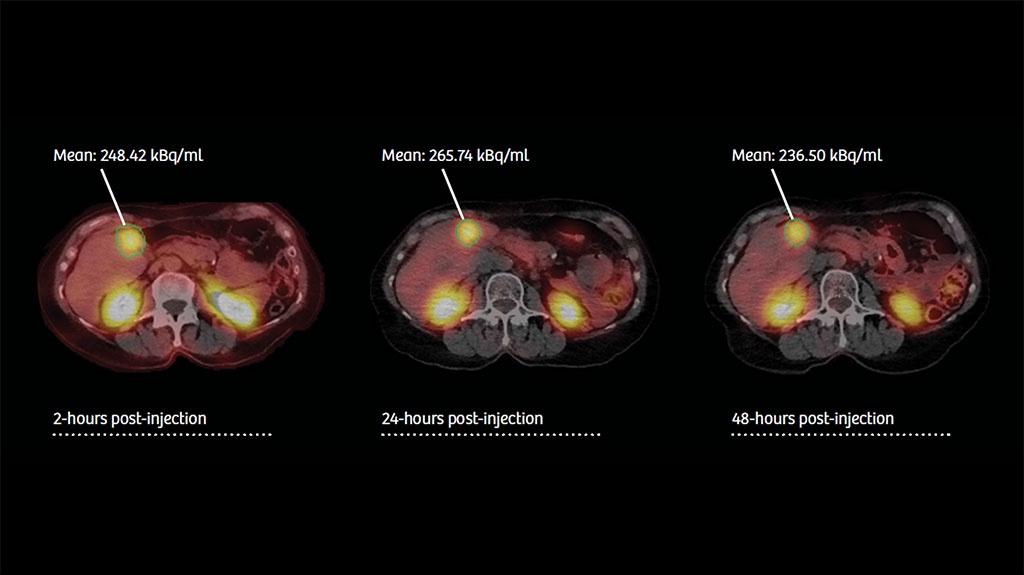 A New Era of Nuclear Medicine