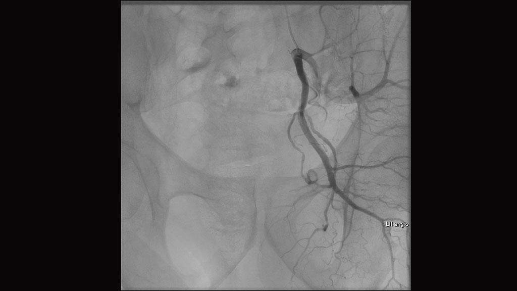 Planning Ahead Makes All the Difference for a Successful PAE