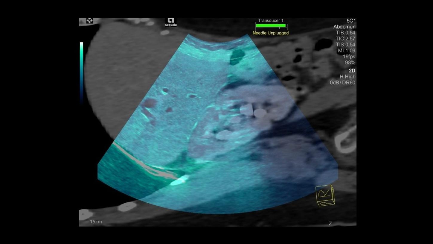 ACUSON Sequoia Ultrasound System