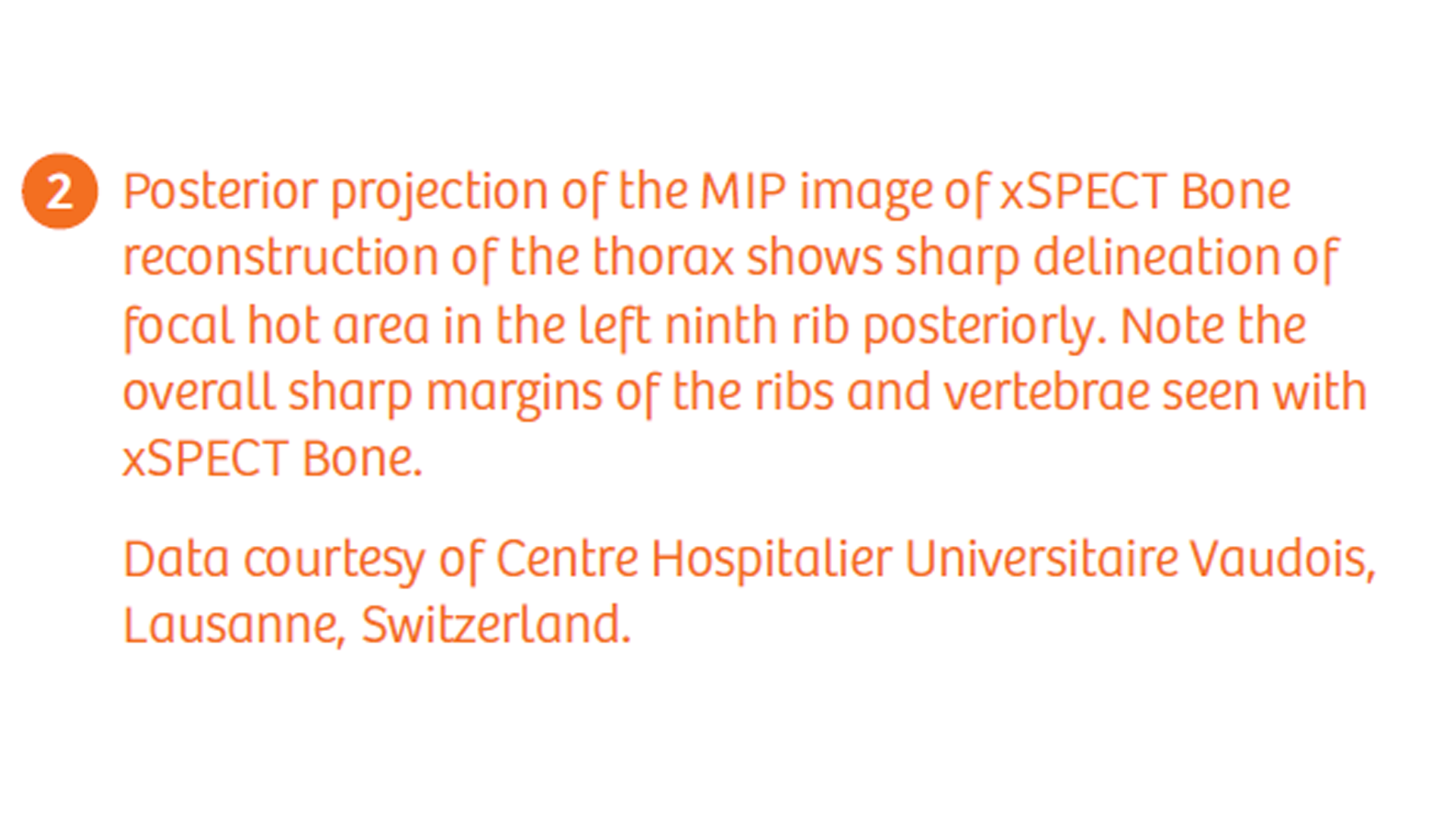 Differentiation of a rib benign lesion from a metastasis using xSPECT Quant