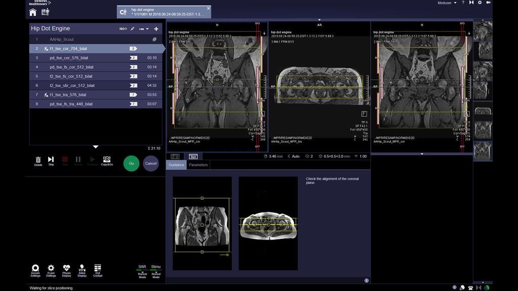 Large Joint Dot Engine