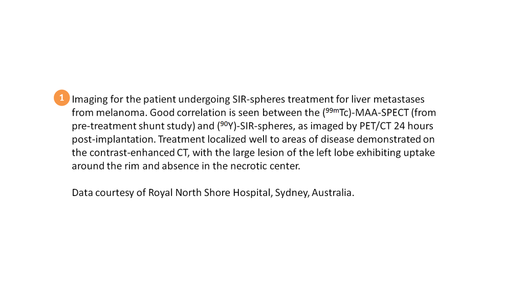 Quantitative SPECT imaging of hepato-pulmonary shunting prior to SIR ...