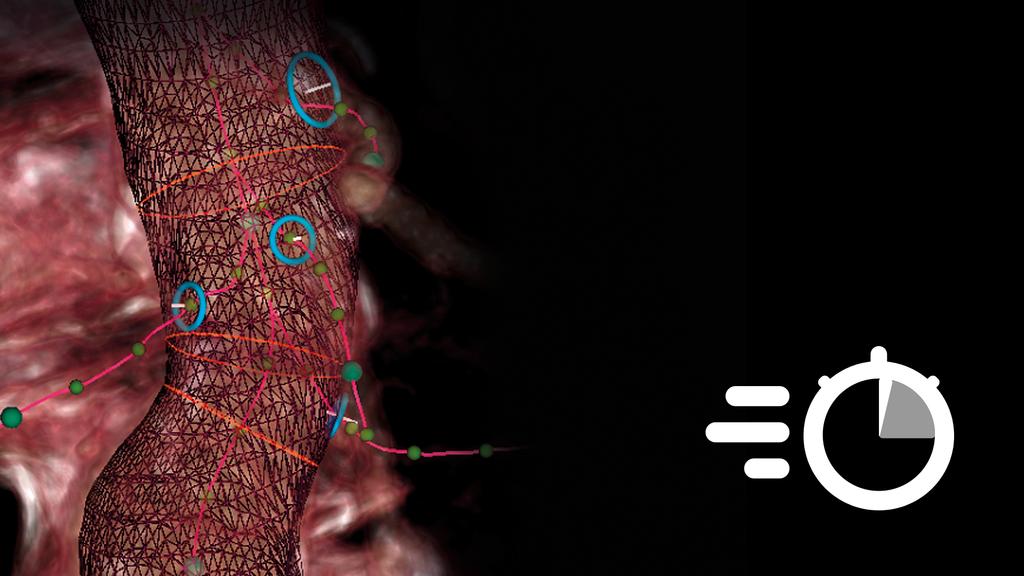 Hybrid OR Imaging Solutions