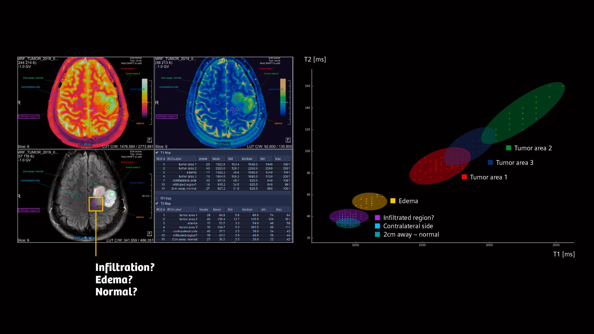 MR Neuro Imaging - MRI Neurology