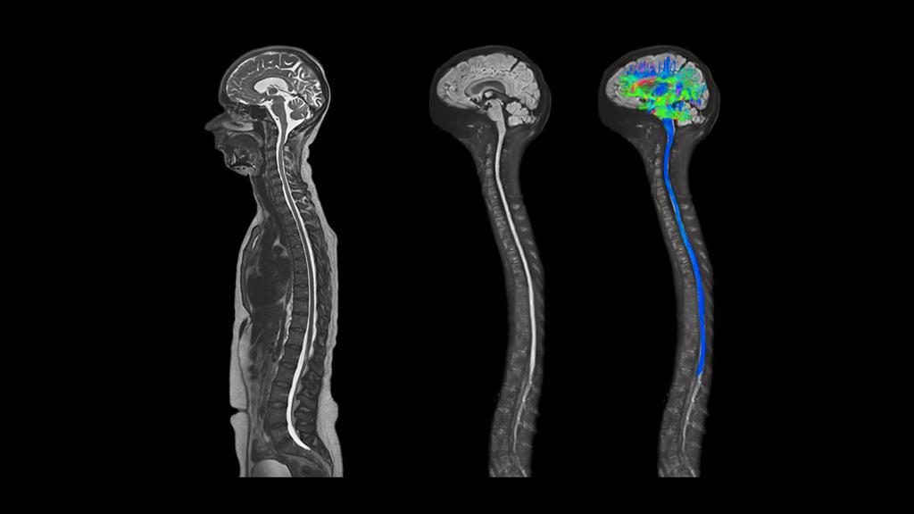 Diffusion Mri Past And Future An Overview