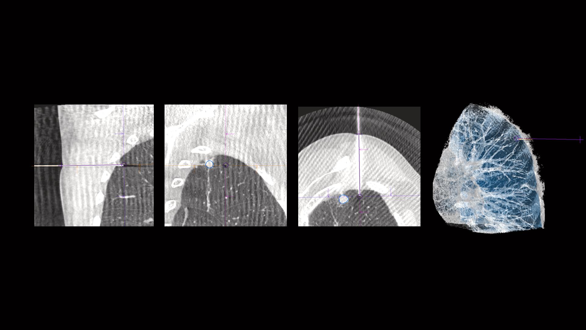 iVATS in the Hybrid OR