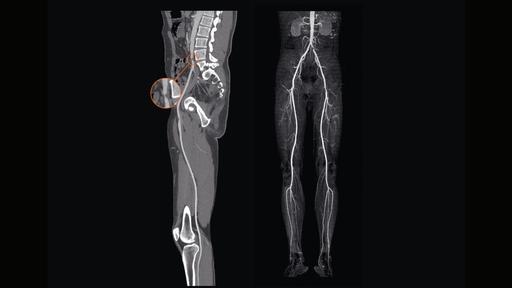 SOMATOM go.Now with myExam Companion