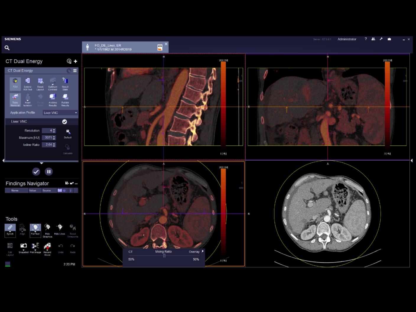 Computed Tomography