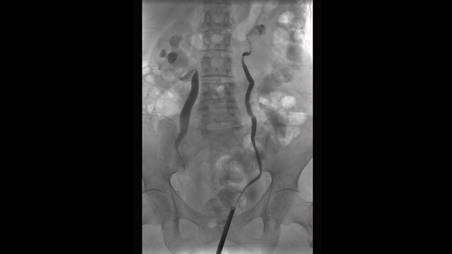 Urology device Uroskop Omnia Max