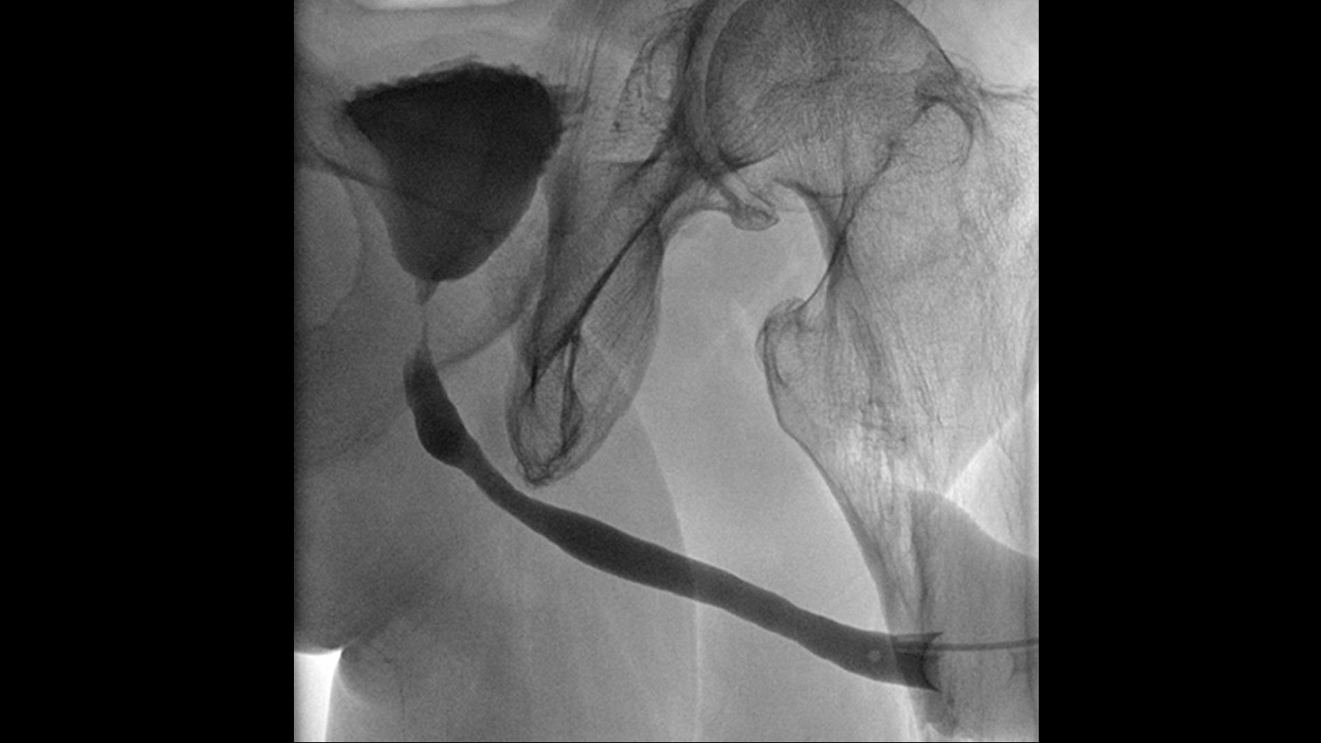 Urology device Uroskop Omnia Max