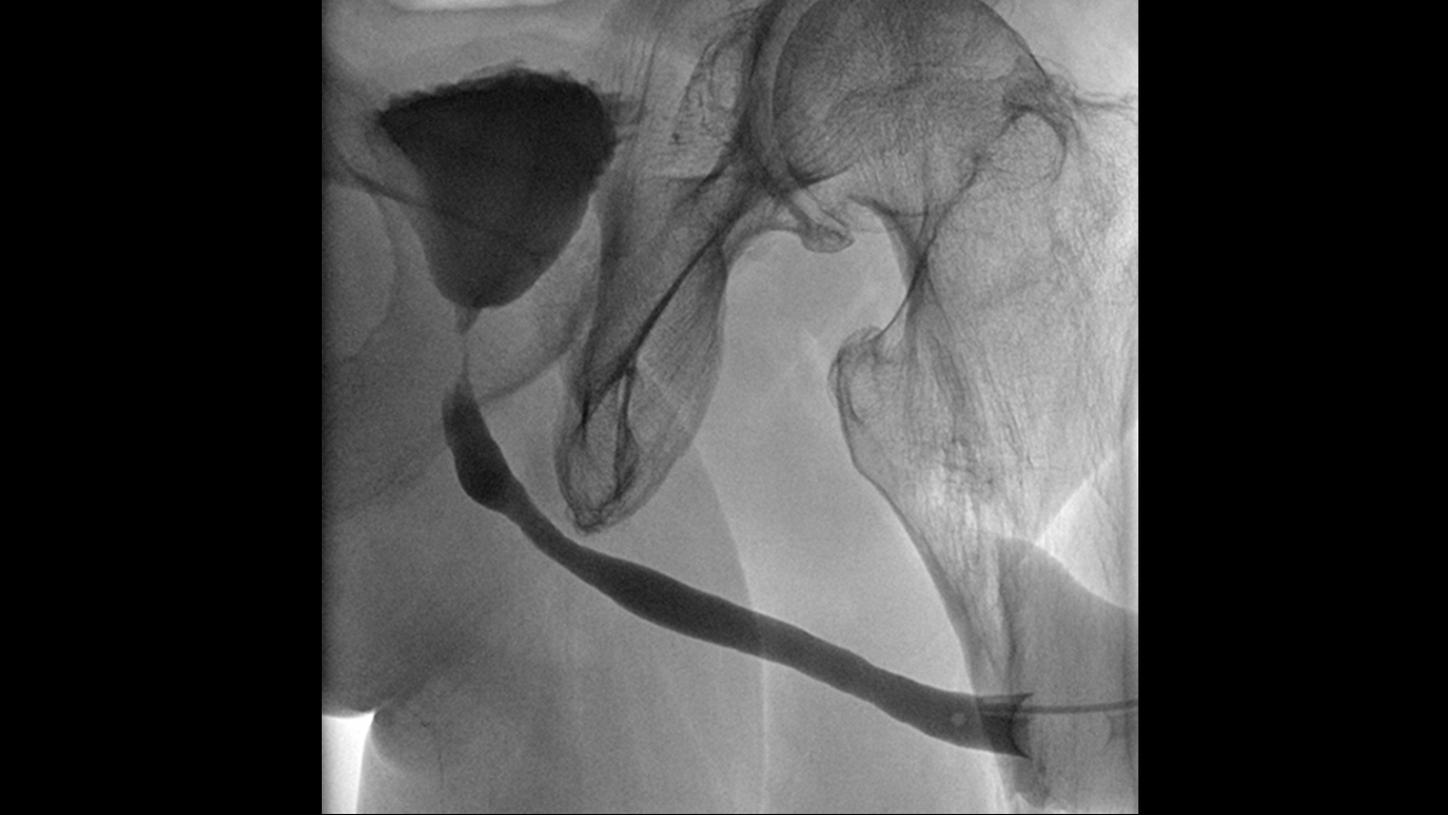 Urology device Uroskop Omnia Max