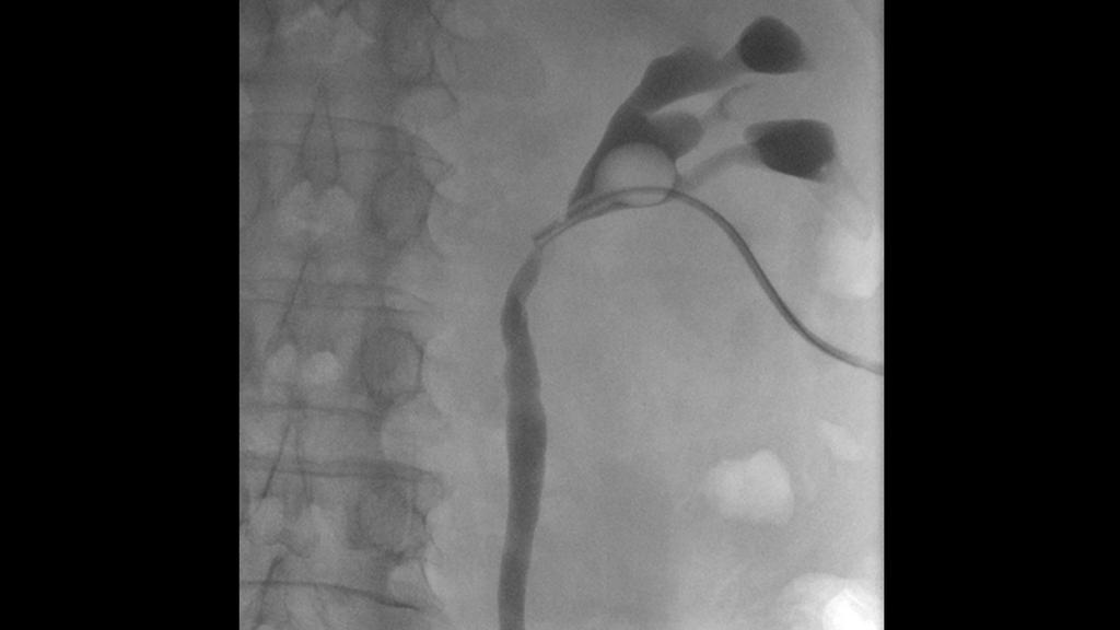 Urology device Uroskop Omnia Max