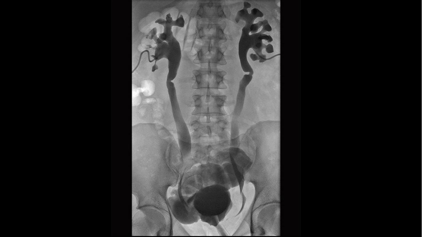 Urology device Uroskop Omnia Max